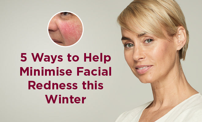 Facial Redness: 5 Ways to Help Minimise Redness - Manuka Doctor